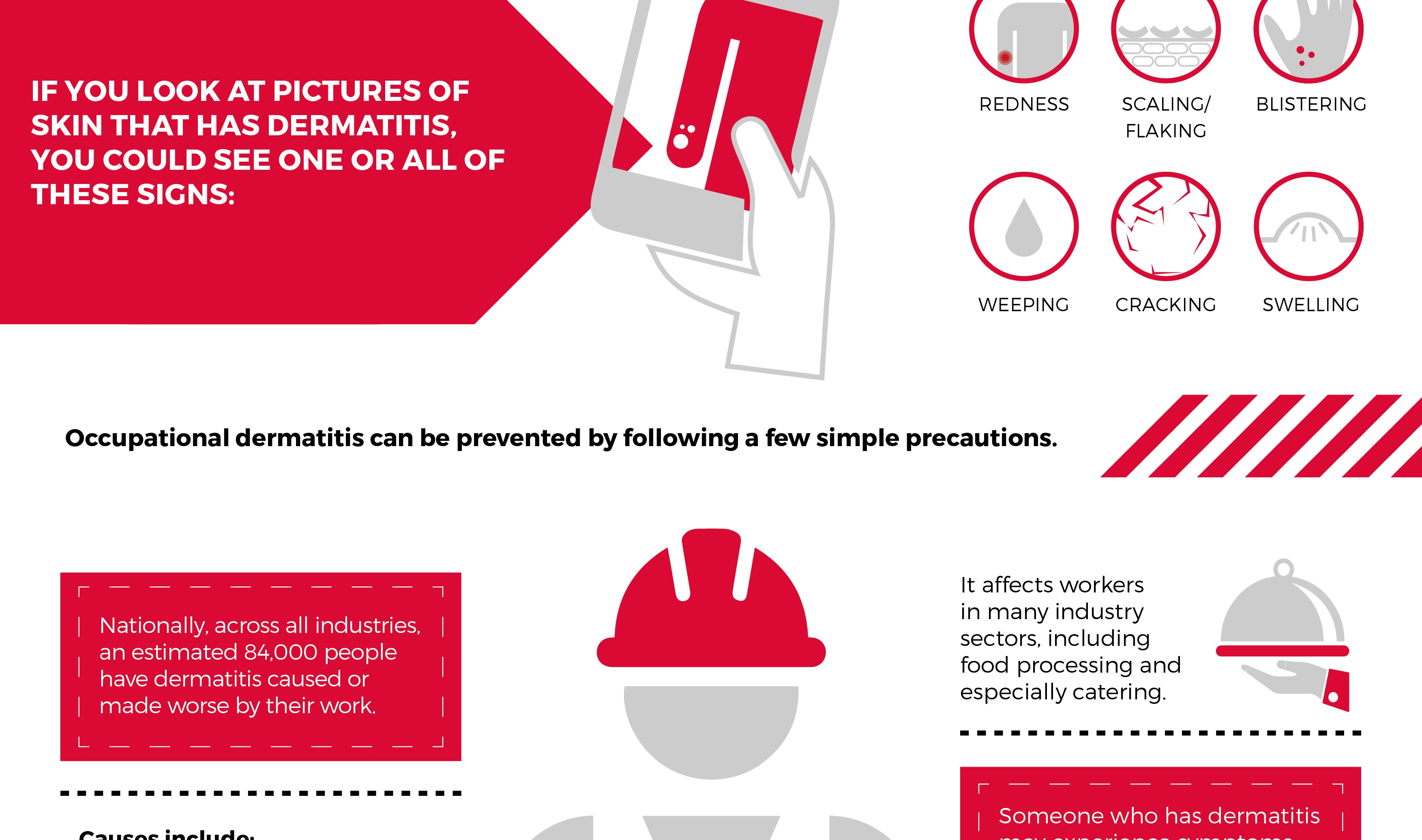 Occupational Dermatitis; The Facts